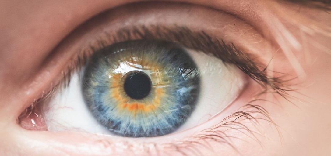 Die besten Methoden, um eine Wimper aus dem Auge zu bekommen - Lash ...